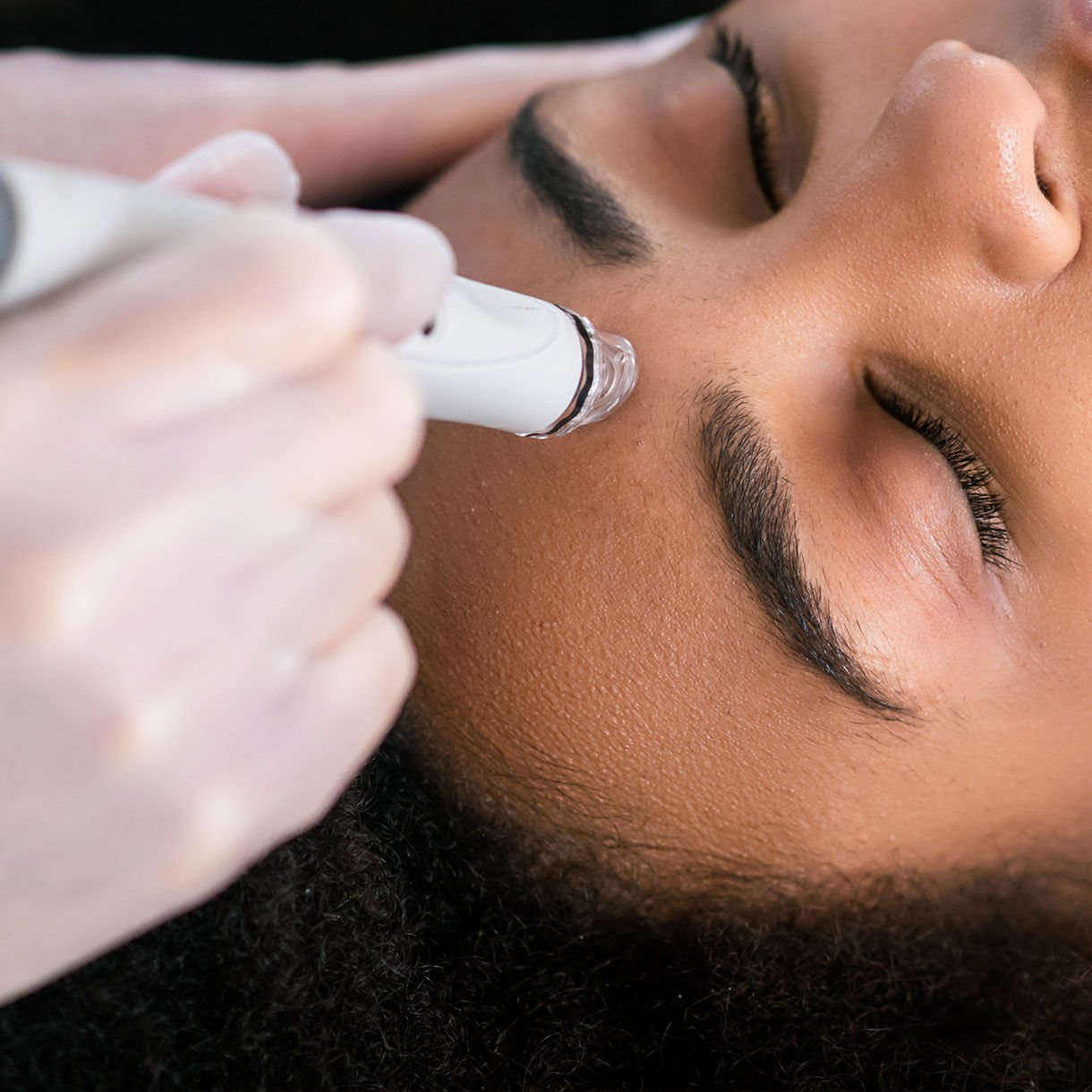Dermaplaning Treatment: Benefits and Cost| Skinceuticals Australia